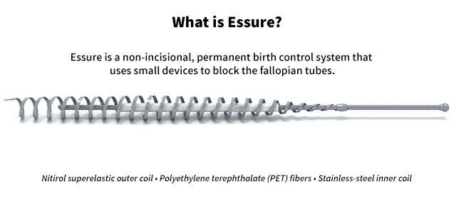 Essure Injury Attorneys | Essure Birth Control Side Effects Lawyers