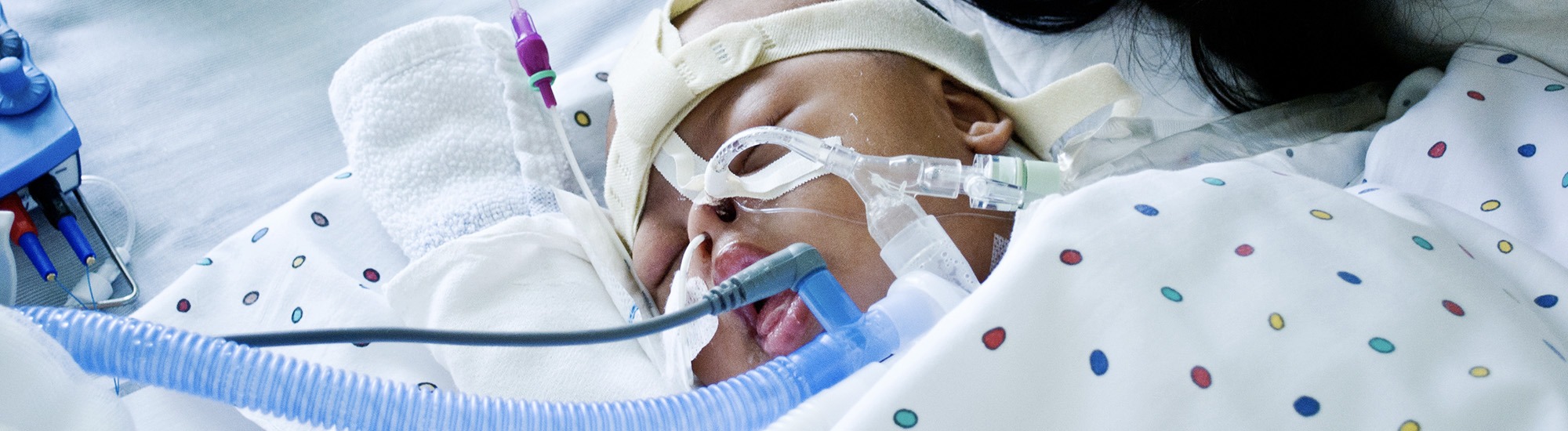 Hypoxic Ischemic Encephalopathy | HIE Newborn Lawyers