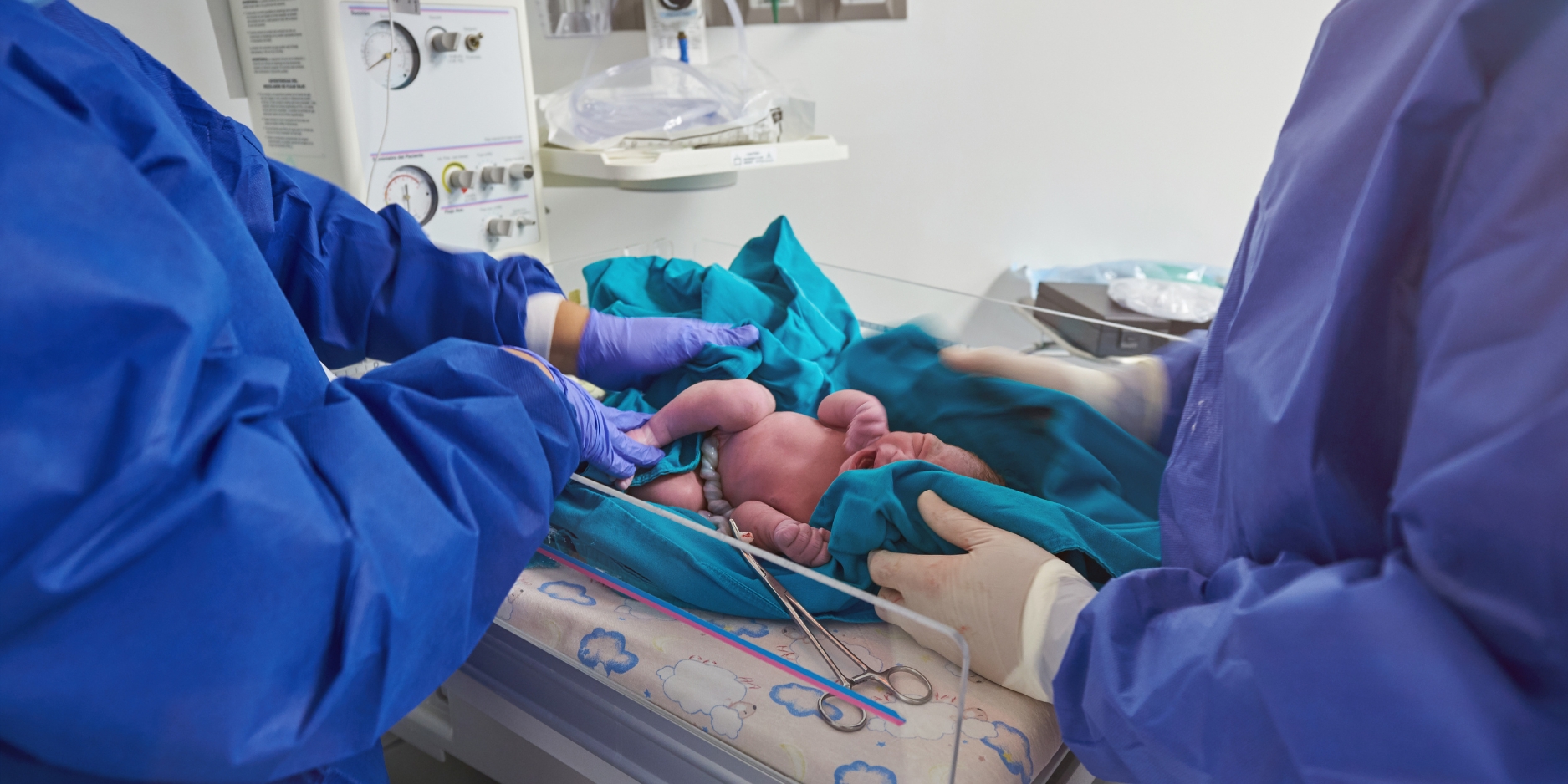 Apgar Score | HIE Lawyer